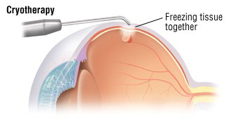 Local treatment options | Children's Wisconsin