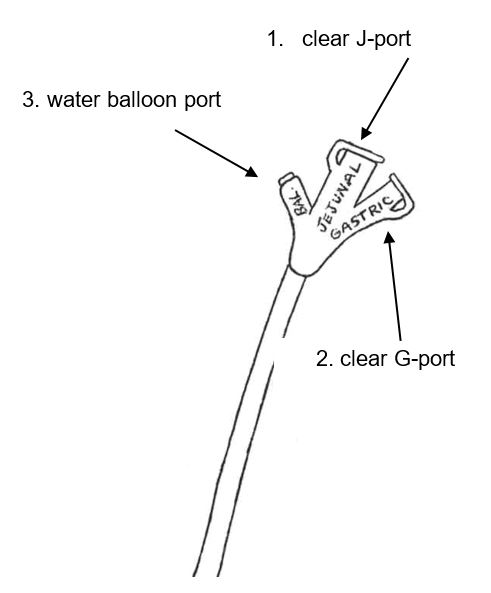 balloon port